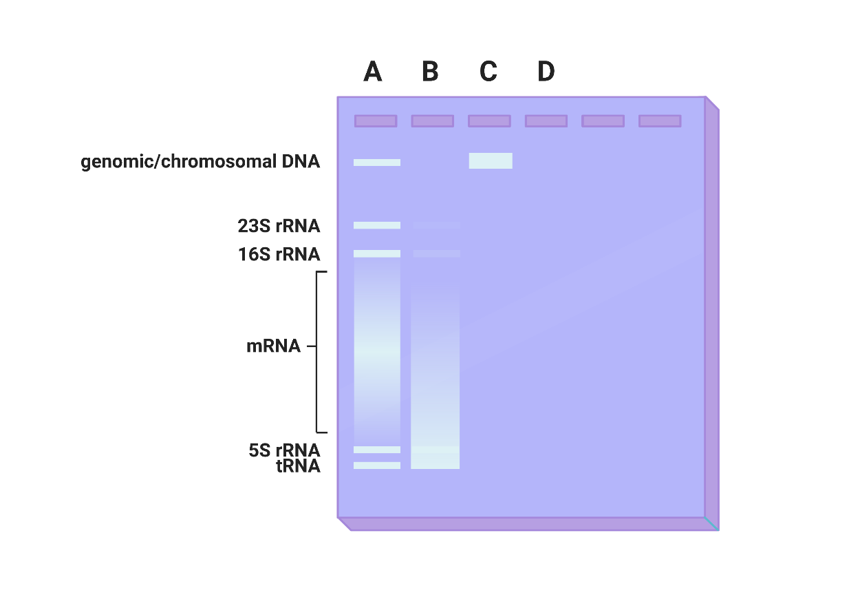 Solved Here is an example of a gel run by a group of | Chegg.com