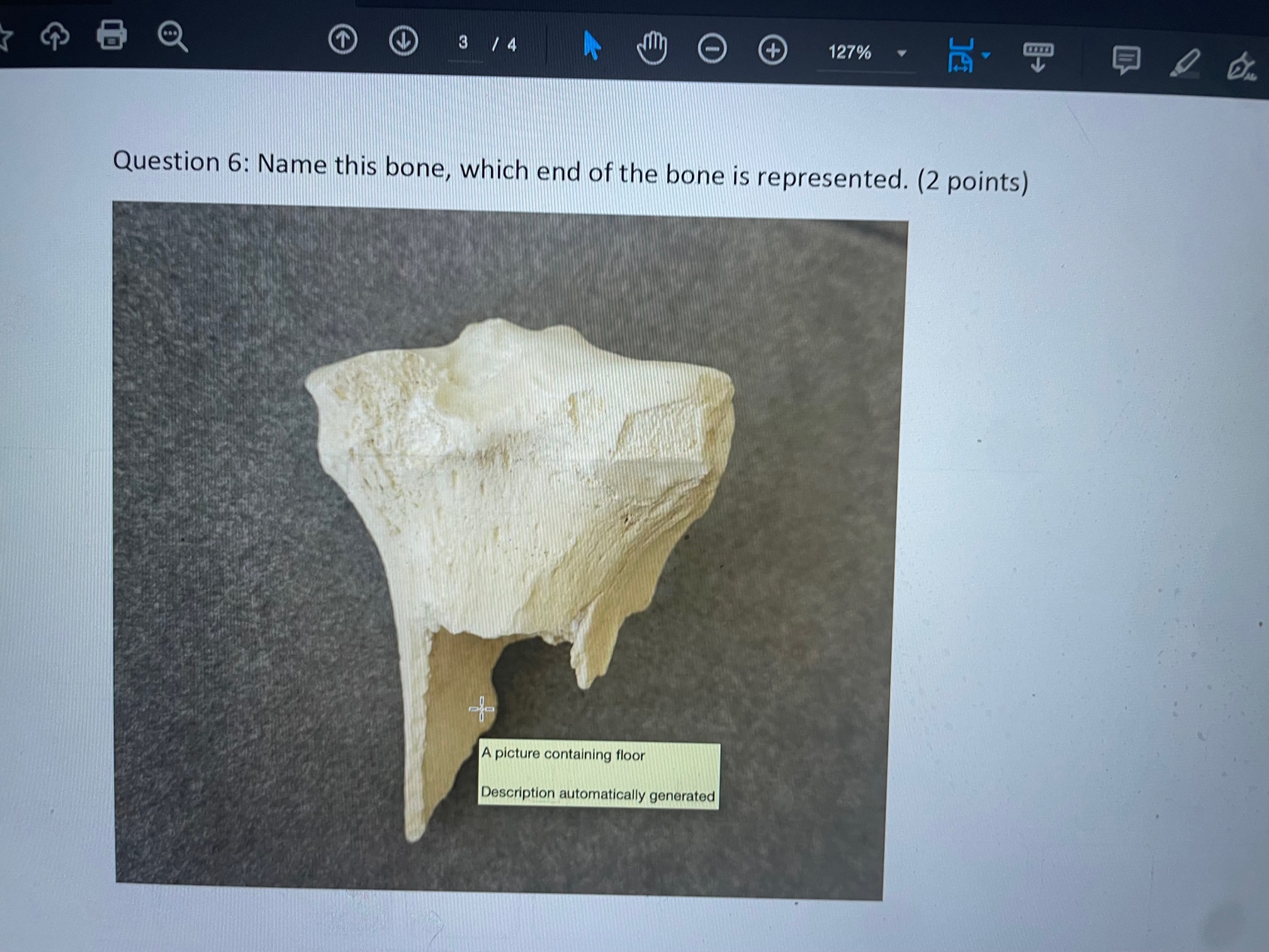 Solved Question 5: Name this bone, the side of the body it's | Chegg.com