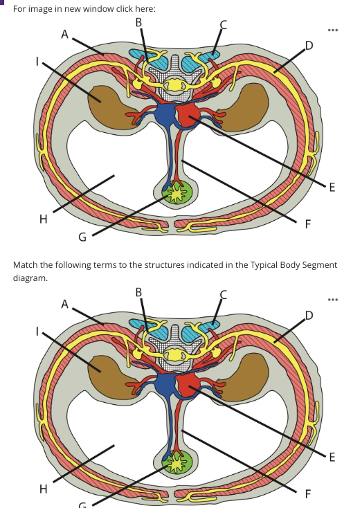 Solved Epaxial muscles Urinary organs Dorsal mesentery | Chegg.com