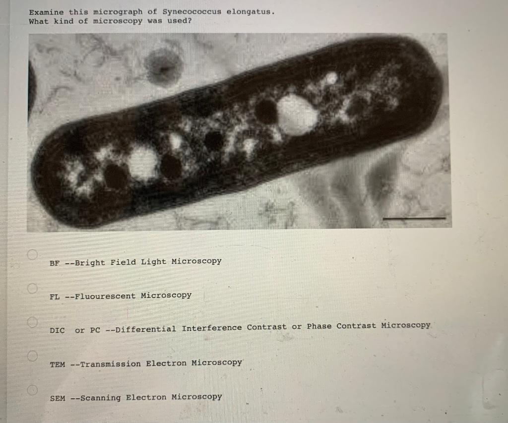 Solved Examine this micrograph of Synecococcus elongatus. | Chegg.com
