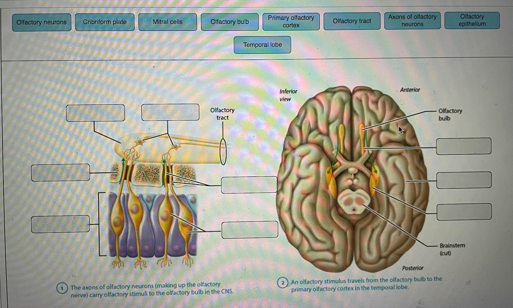 Solved Olfactory neurons Cribriform plate Mitral cells | Chegg.com