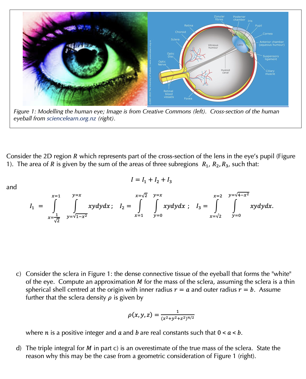 Solved Zonular fibres Posterior chamber Iris Pupil Retina | Chegg.com