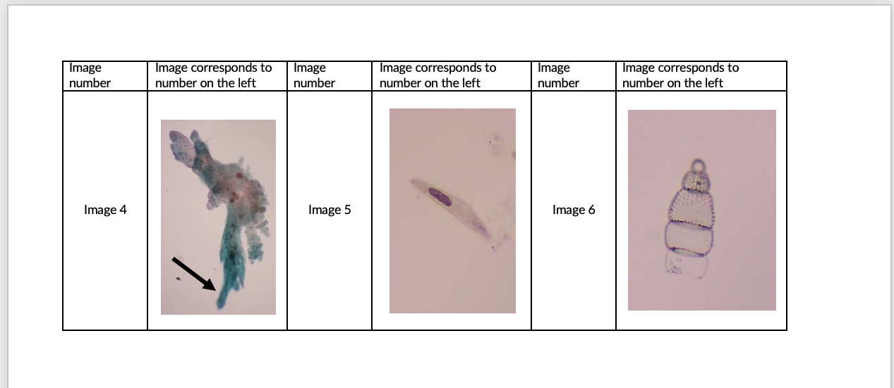 Solved Activity 4: Identification of Unknowns: protists | Chegg.com