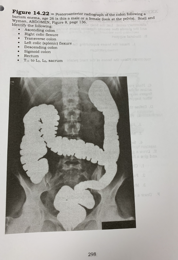 Solved gure 14.22- Posteroanterior radiograph of the colon | Chegg.com