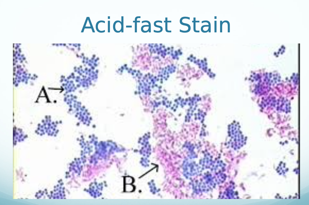 Solved B bacteria is acid-fast 1. which is the shape of an | Chegg.com