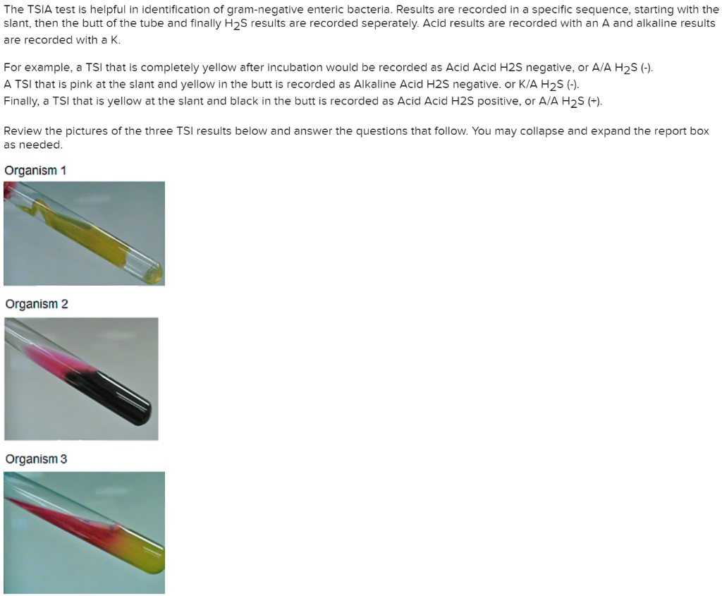 Solved The TSIA test is helpful in identification of | Chegg.com