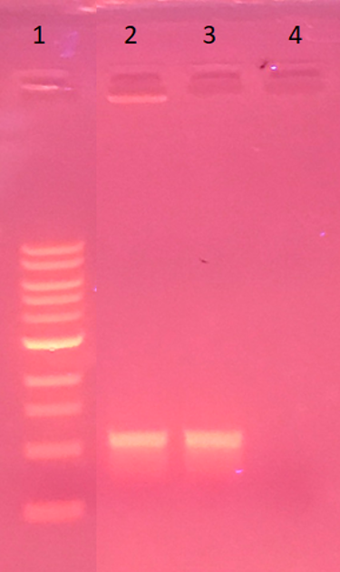 Solved You pick 3 different colonies on your transformation | Chegg.com