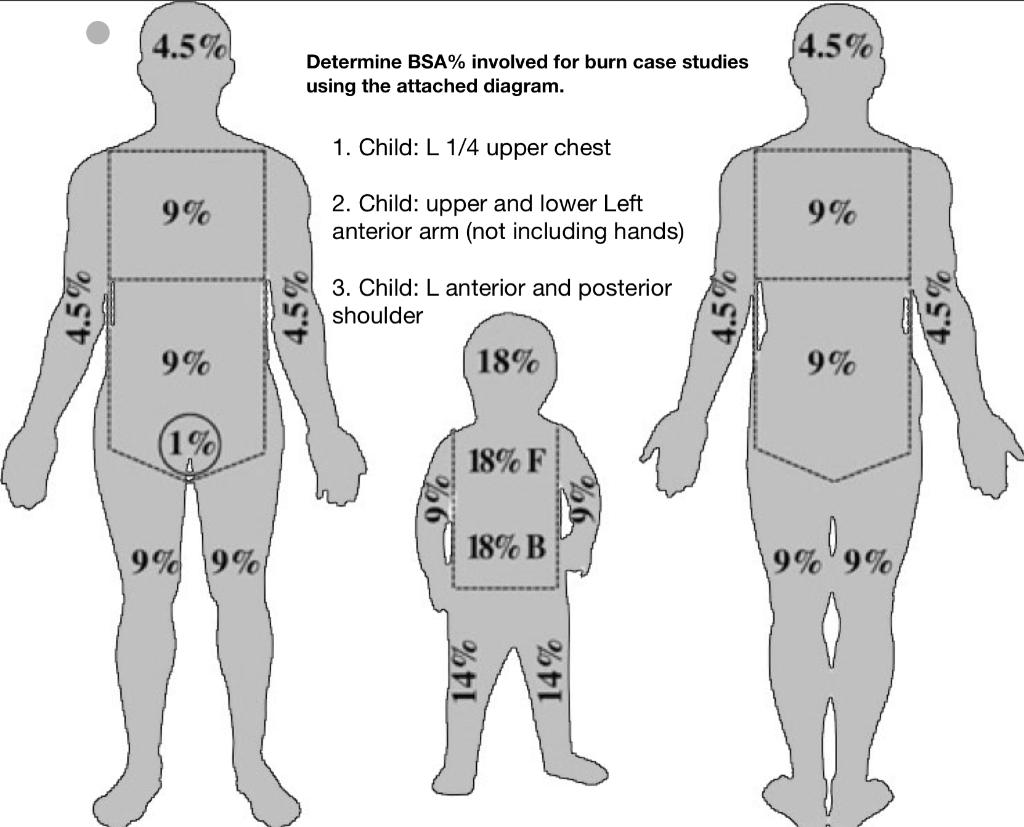 Solved 4.5% 4.5% Determine BSA% involved for burn case | Chegg.com