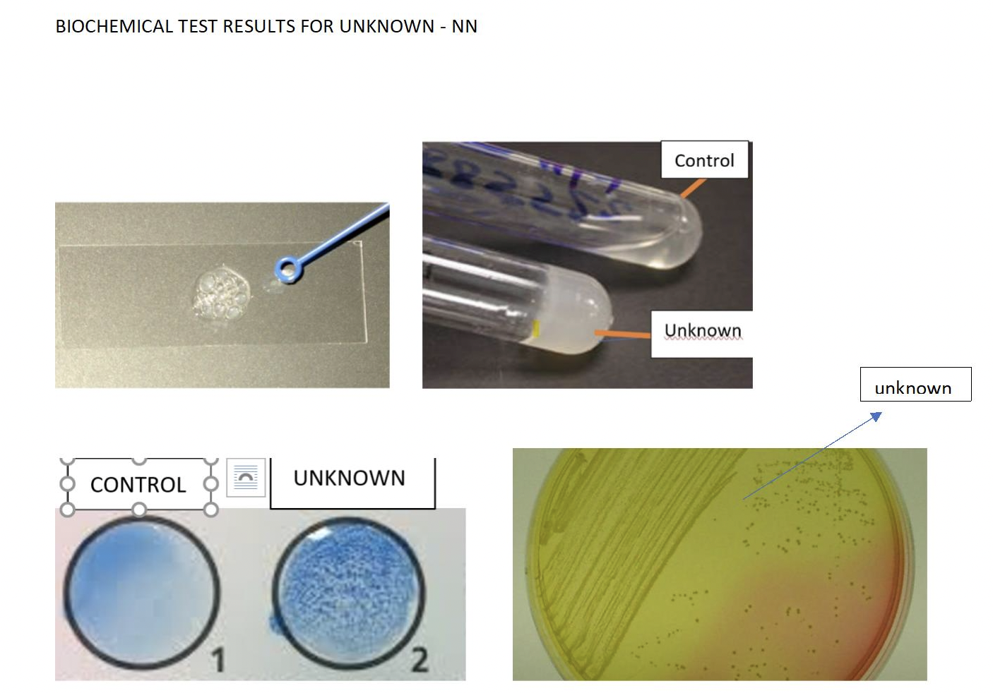 Look at the biochemical test results attached | Chegg.com