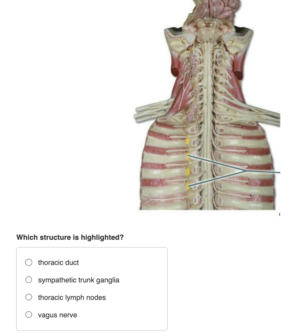Solved Which structure is highlighted? thoracic duct | Chegg.com