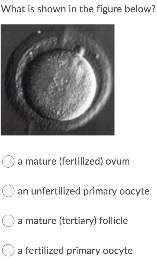 Solved What is shown in the figure below? a mature | Chegg.com