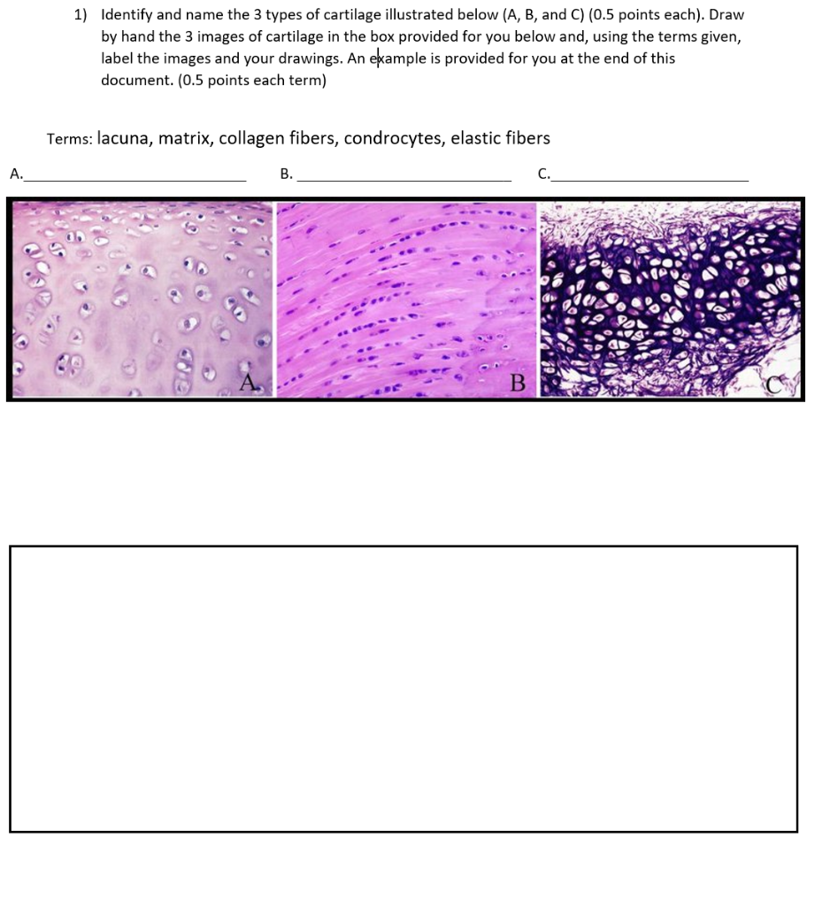 Solved 1) Identify and name the 3 types of cartilage | Chegg.com