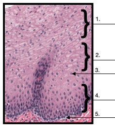 Solved A. ANSWER THE FOLLOWING PARTS: 1. Simple Squamous | Chegg.com