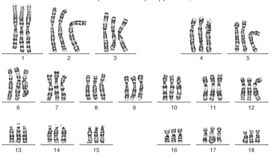 Solved How many complete sets of chromosomes does this have? | Chegg.com