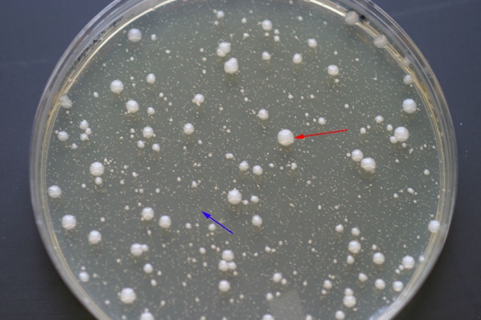 Solved Describe the pattern of growth of the colonies | Chegg.com