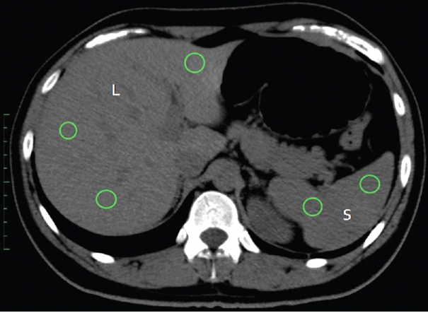 Solved This image is a part of a multi-phase CT Abdomen | Chegg.com