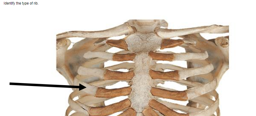 Solved Identify the type of rib. | Chegg.com