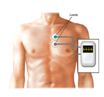 Solved identify the device shown.Pacemaker Pulse | Chegg.com