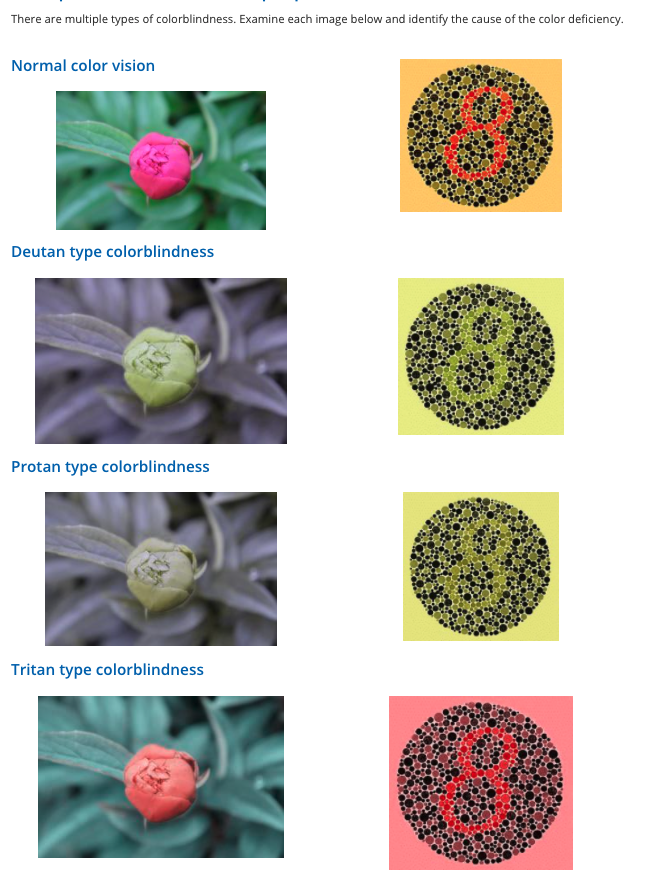 Solved There are multiple types of colorblindness. Examine | Chegg.com