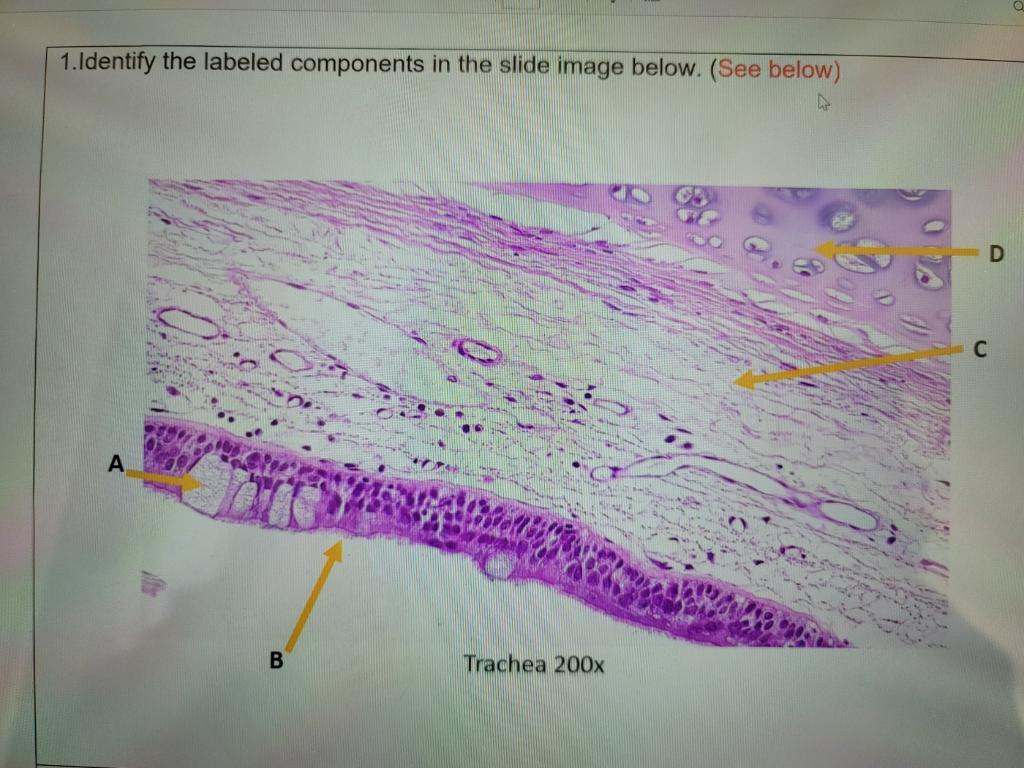 1.Identify the labeled components in the slide image | Chegg.com