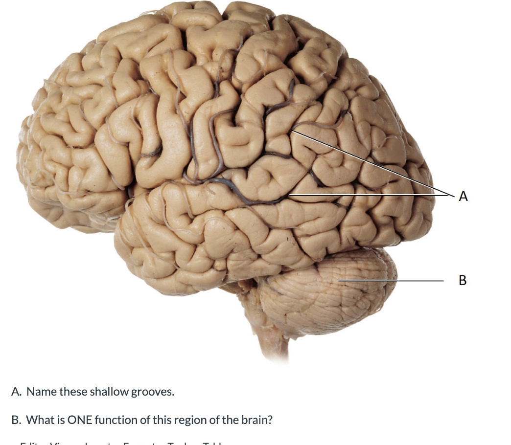 Solved A. Name these shallow grooves. B. What is ONE | Chegg.com