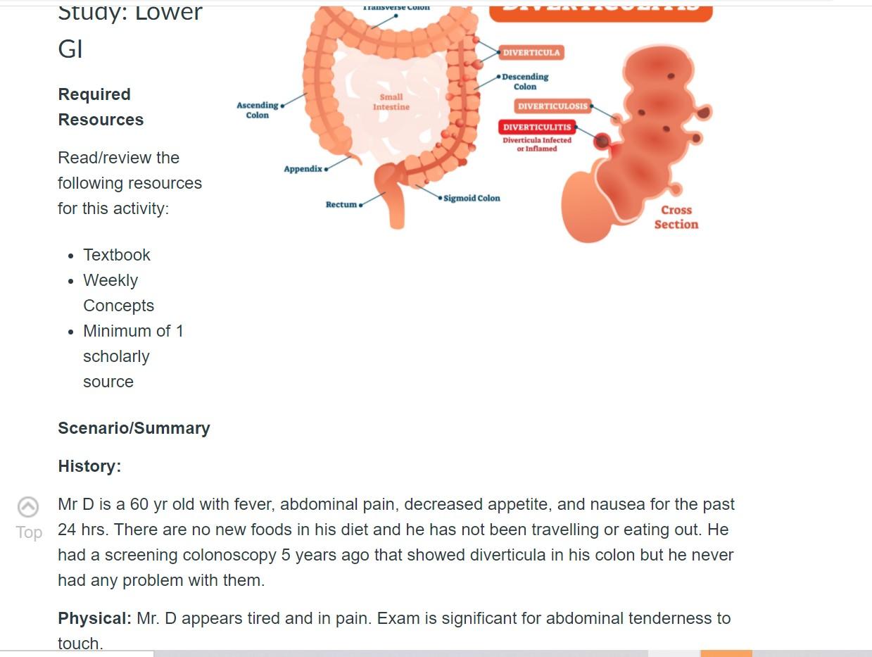 Solved Sverse CUI Study: Lower GI DIVERTICULA Descending | Chegg.com