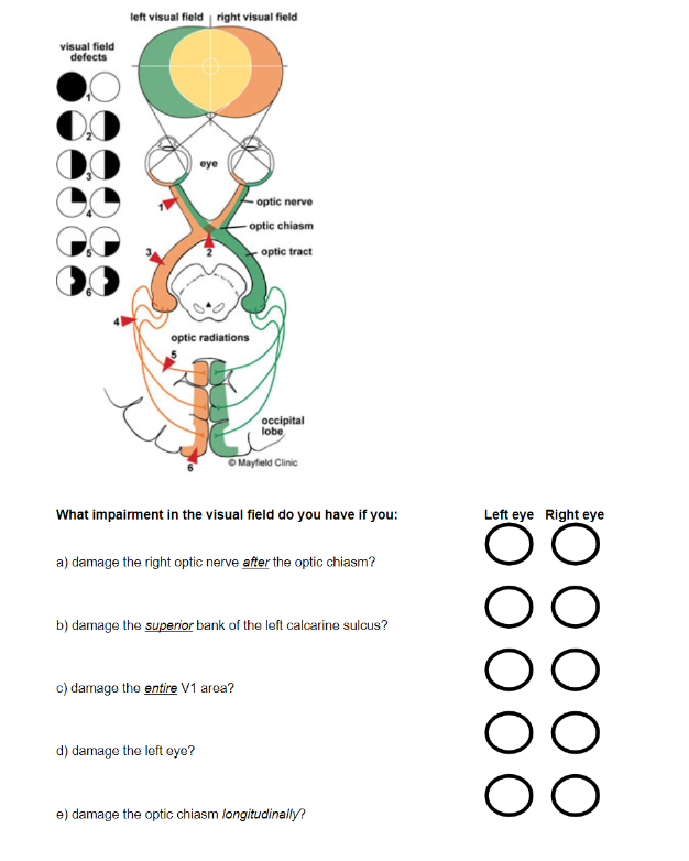 Solved left visual field right visual field visual field | Chegg.com