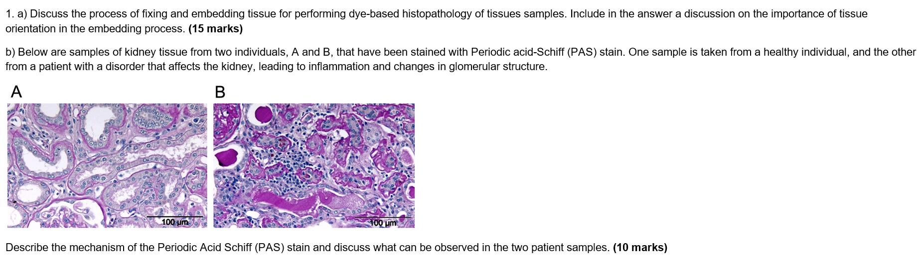 Solved 1. a) Discuss the process of fixing and embedding | Chegg.com