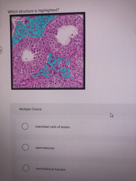 Solved Which structure is highlighted? Multiple Choice | Chegg.com
