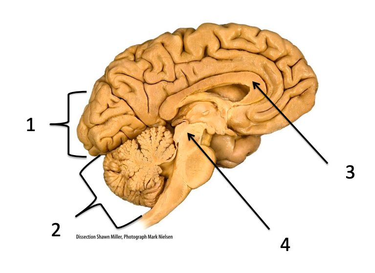 Solved 1 3 2 Dissection Shawn Miller, Photograph Mark | Chegg.com