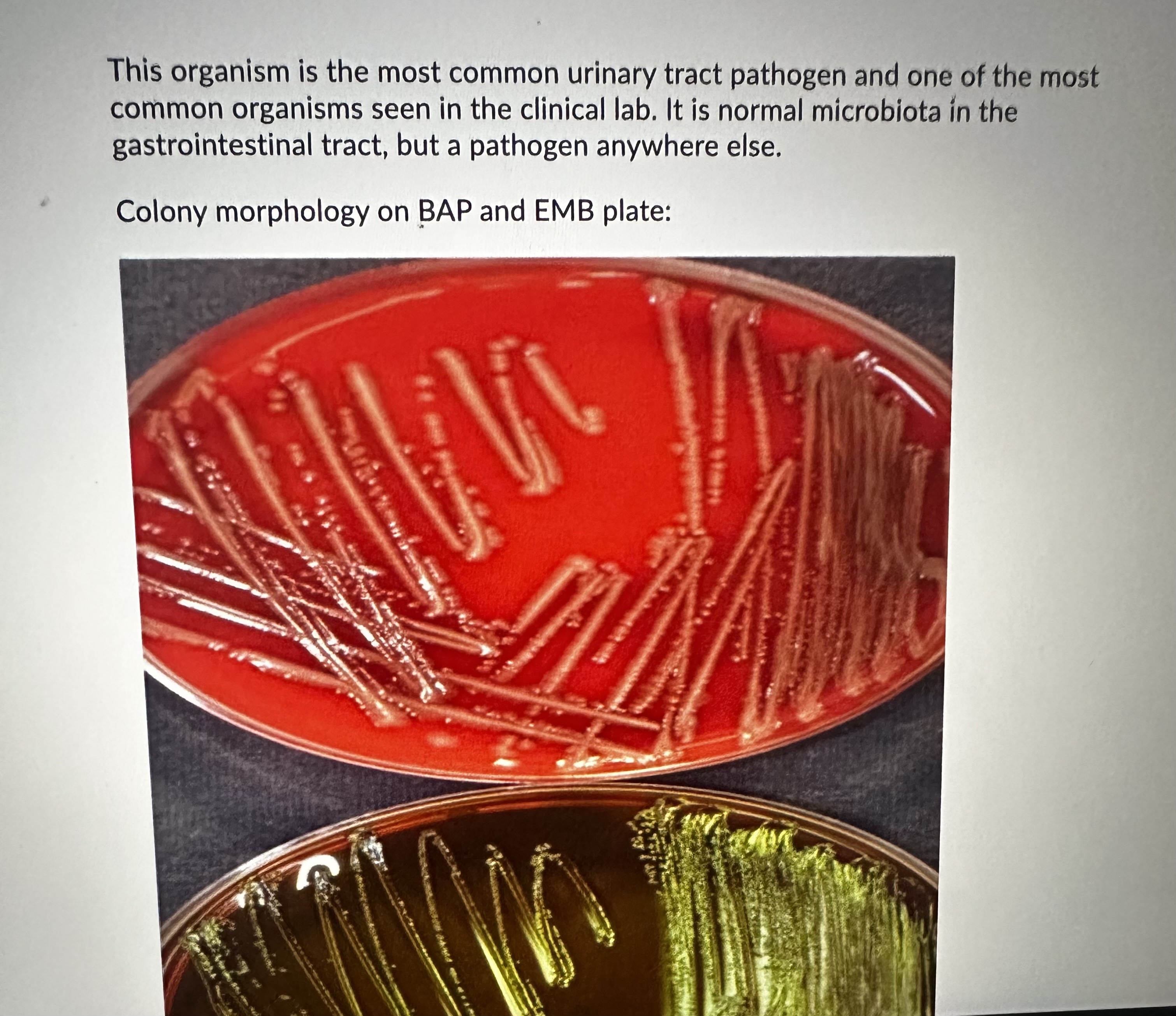 Solved This organism is the most common urinary tract | Chegg.com