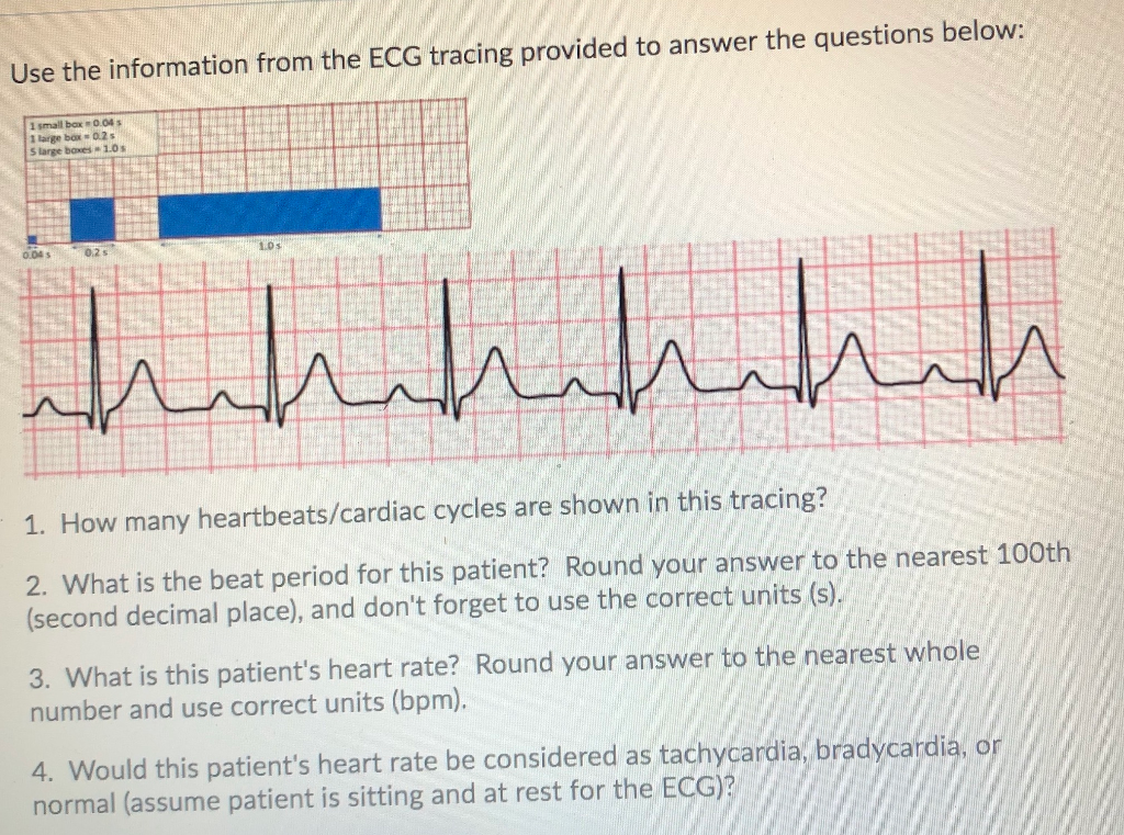 Solved Use the information from the ECG tracing provided to | Chegg.com