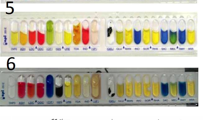 Solved Using the API 20 E diagnostic tool, identify all | Chegg.com