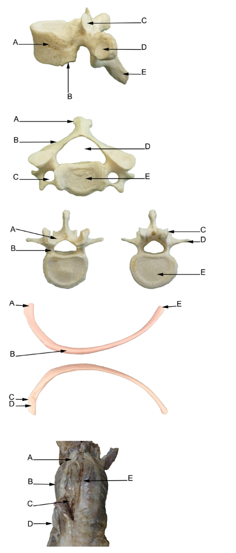 Identify the following labelled structures | Chegg.com