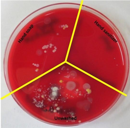 Solved MICROBIOLOGY PLEASE HELP Exercise 1: Bacterial | Chegg.com