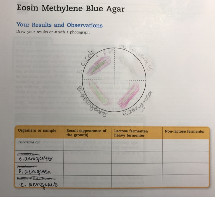 Eosin Methylene Blue Agar