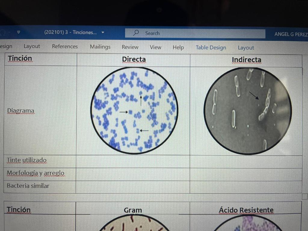 Solved Please help, MICROBIOLOGICAL STAINS • SIMPLE, | Chegg.com