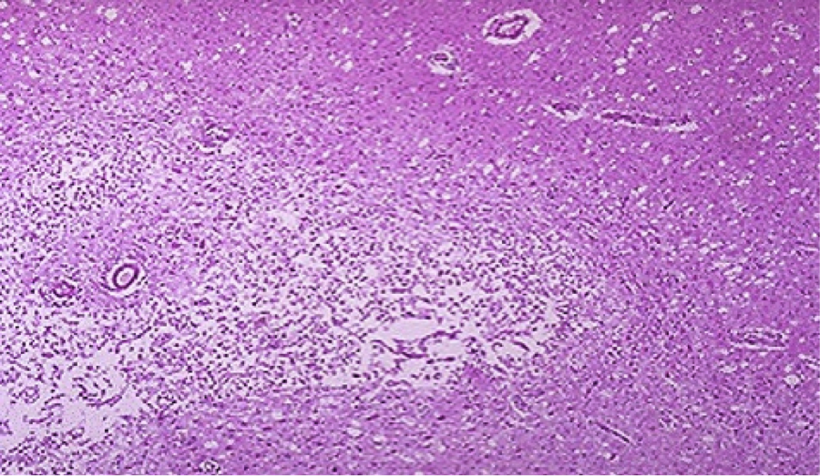 Solved 1. What does it mean to be caseous? Do not answer | Chegg.com