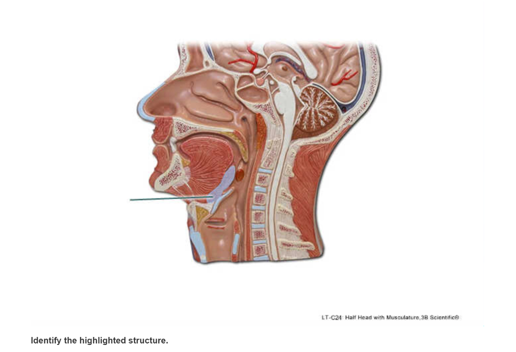 Solved Model courtesy of Denayer-Geppert, www denoyer.com | Chegg.com