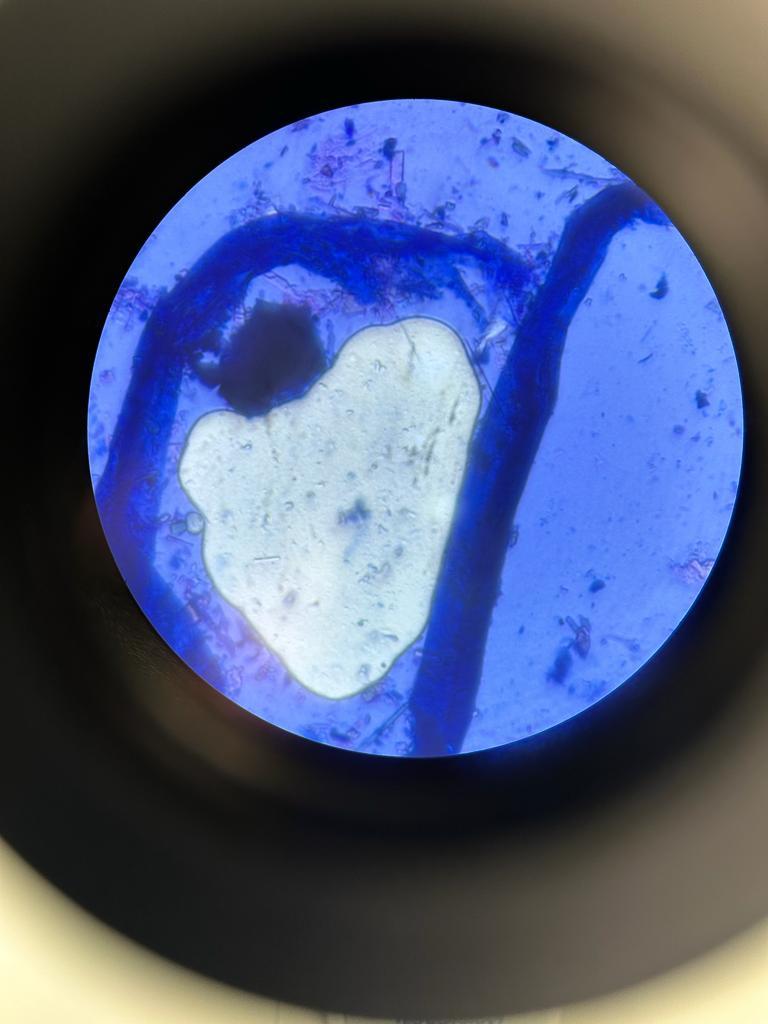 Solved 1. What is the procedure of methyl blue staining? 2. | Chegg.com