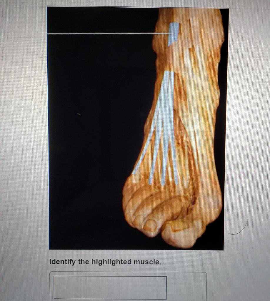 Solved Identify the highlighted muscle. Identify the | Chegg.com