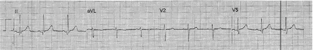 Solved Use 2 methods to estimate the heart rate. 1. sequence | Chegg.com