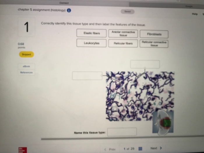 Solved: Assignment (histology) Saved Correctly Identify Th... | Chegg.com Solved: Assignment (histology) Saved Correctly Identify Th... | Chegg.com
