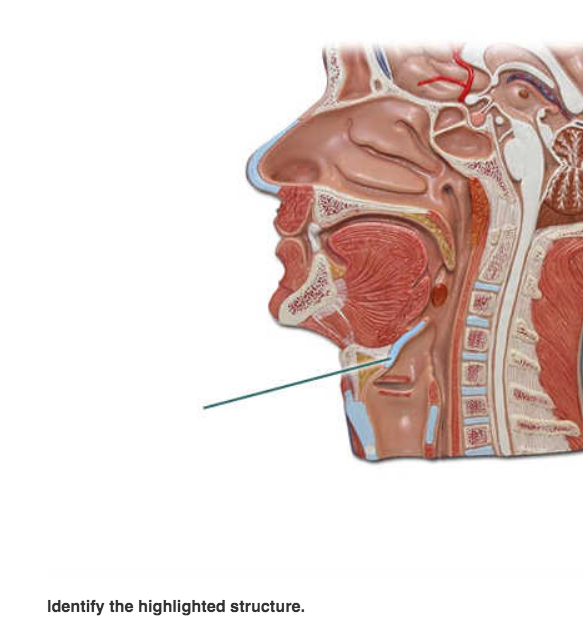 Solved Which structures are highlighted? Identify the | Chegg.com