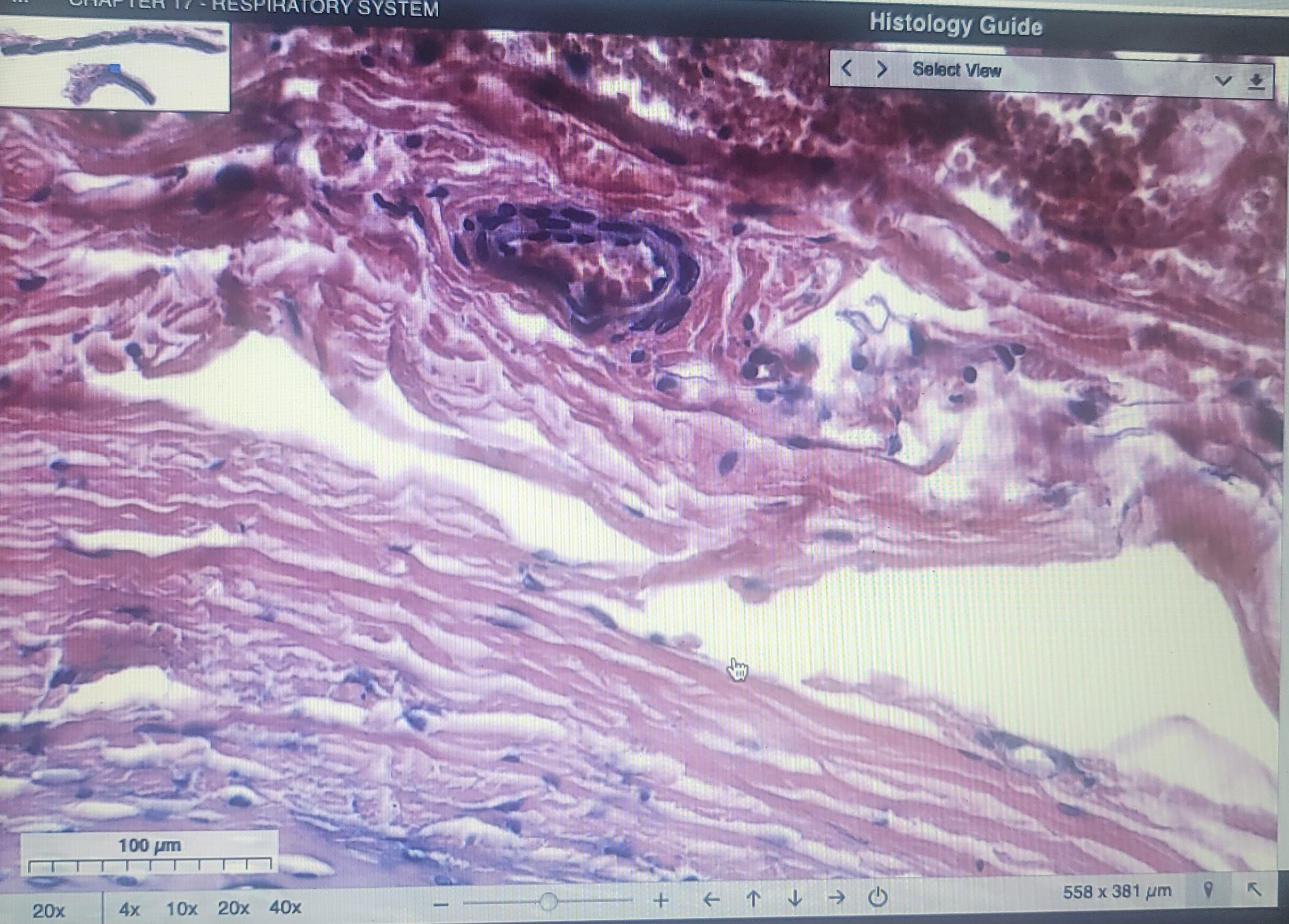 Solved trachealabel the image pointing totype of epithelium | Chegg.com