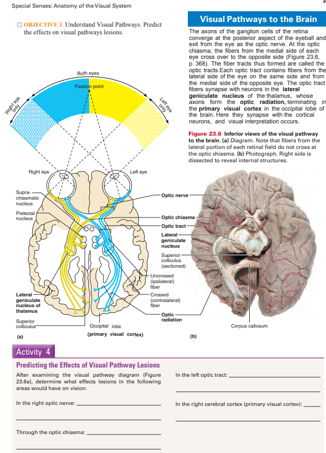Solved Special Senses: Anatomy of the Visual System Rumivy 4 | Chegg.com