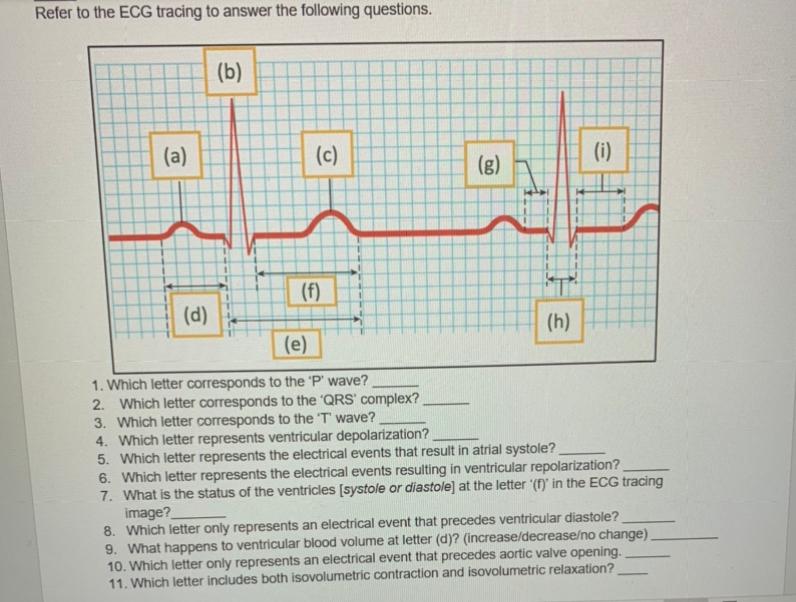 Solved Refer to the ECG tracing to answer the following | Chegg.com