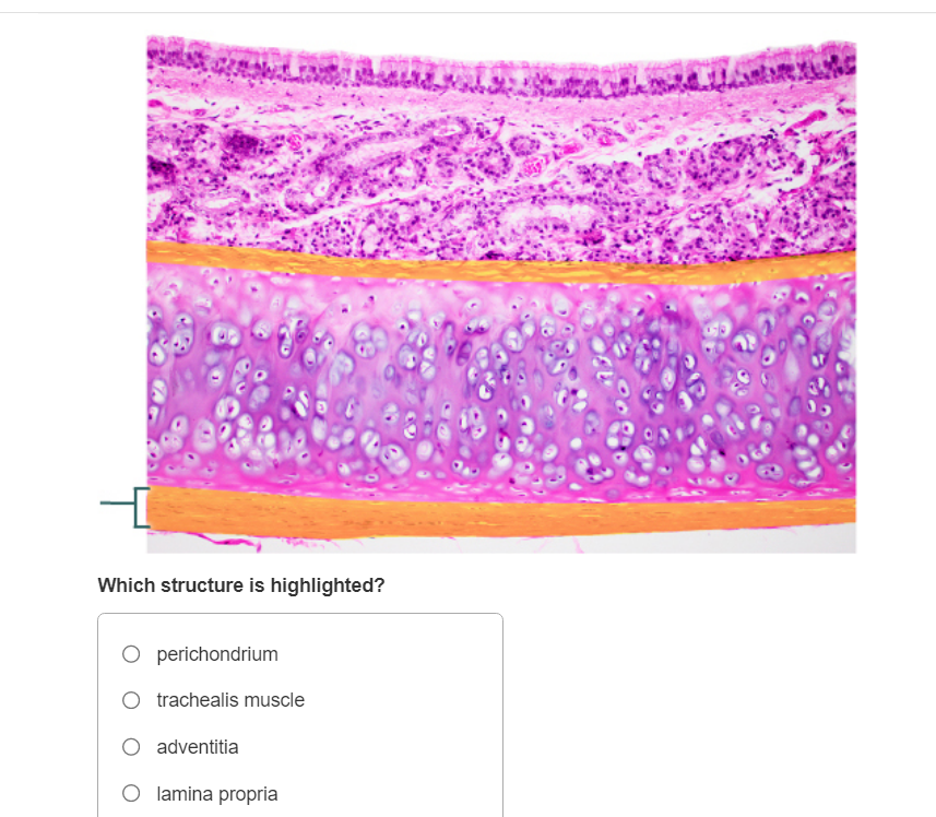 Solved Which structure is highlighted? perichondrium | Chegg.com