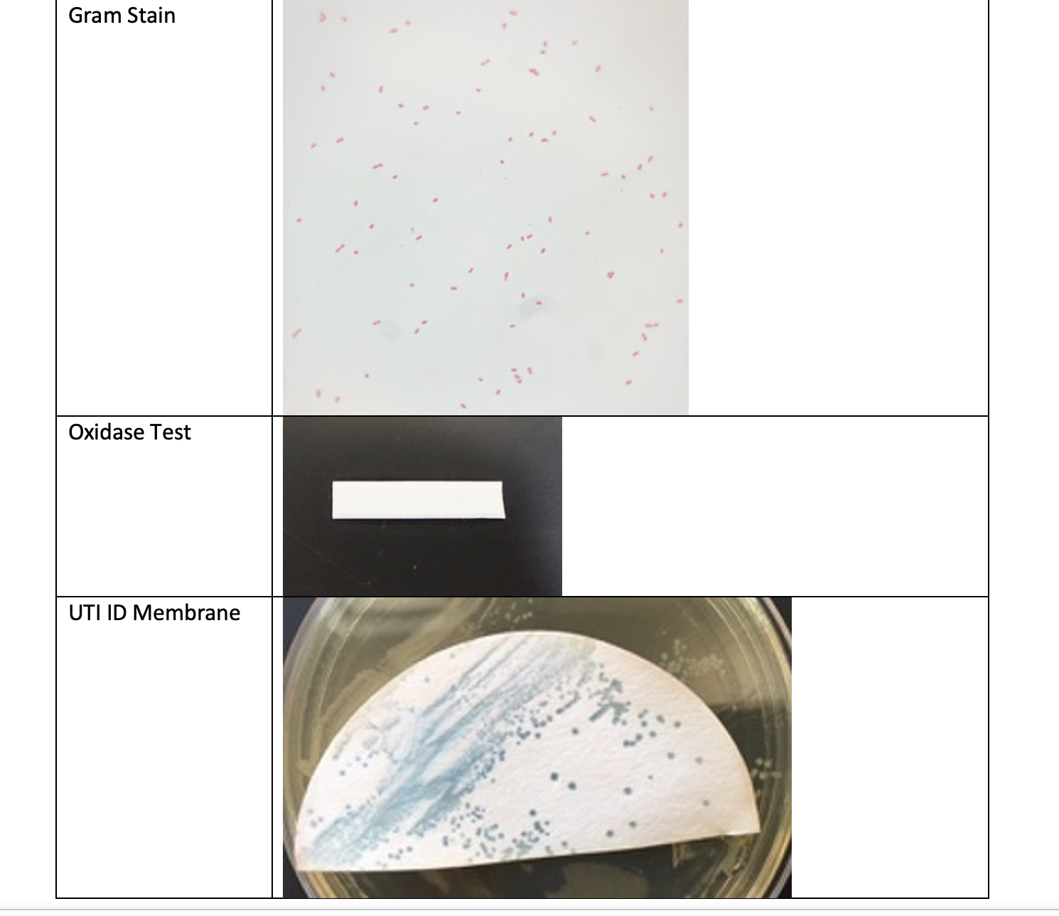 Solved I have to do a lab report about an unknown bacteria. | Chegg.com