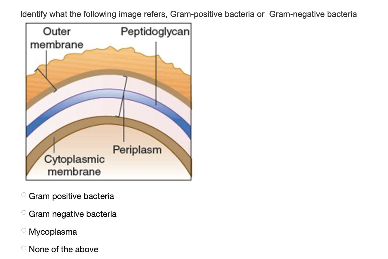 Solved Identify what the following image refers, | Chegg.com
